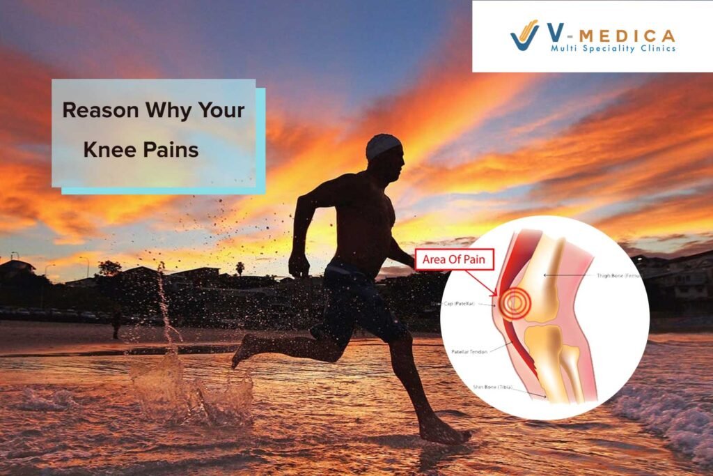 Runner’s Knee and How It’s Treated